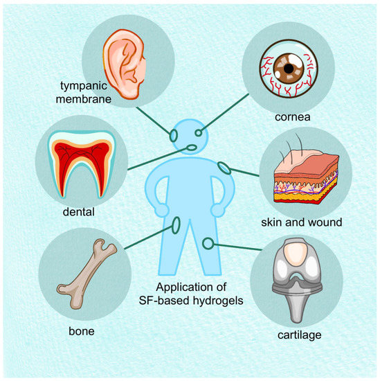Application of Silk-Fibroin-Based Hydrogels in Tissue Engineering
