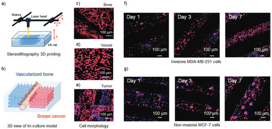 3D Bioprinting as a Powerful Technique for Recreating the Tumor ...