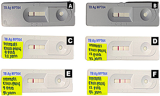 Gels | Free Full-Text | Gel Protein Extraction’s Impact on ...