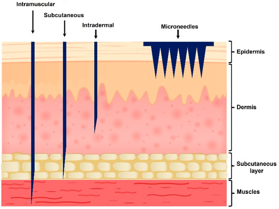 Dissolving and Swelling Hydrogel-Based Microneedles: An Overview of ...