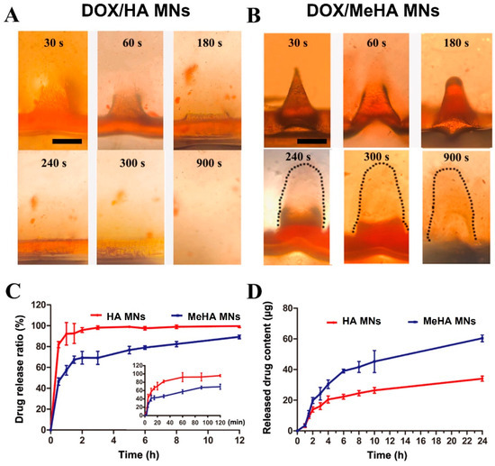 Dissolving and Swelling Hydrogel-Based Microneedles: An Overview of ...