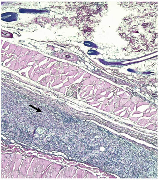 The Effects of Pectin–Honey Hydrogel in a Contaminated Chronic Hernia ...