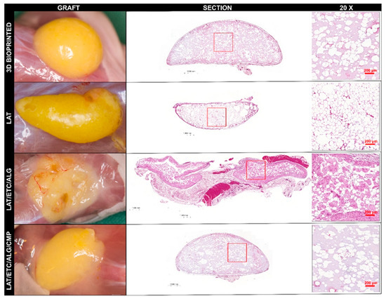 Injectable In Situ Crosslinking Hydrogel for Autologous Fat Grafting
