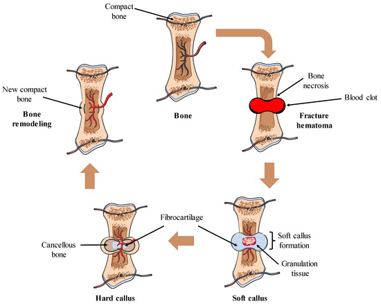Advanced Hydrogel-Based Strategies for Enhanced Bone and Cartilage ...