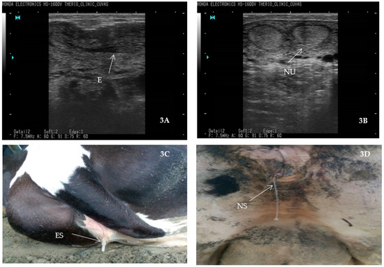 Recent Trends in S. aureus and E. coli-Based Endometritis, and the ...