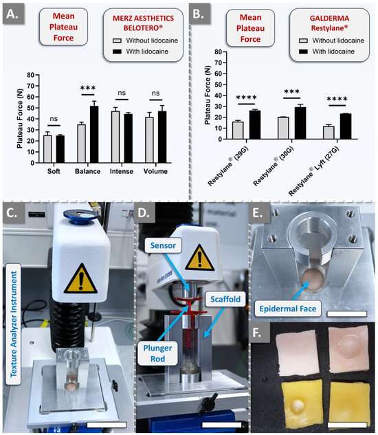 Gels | Free Full-Text | Clinical Perspectives on the Injectability of ...