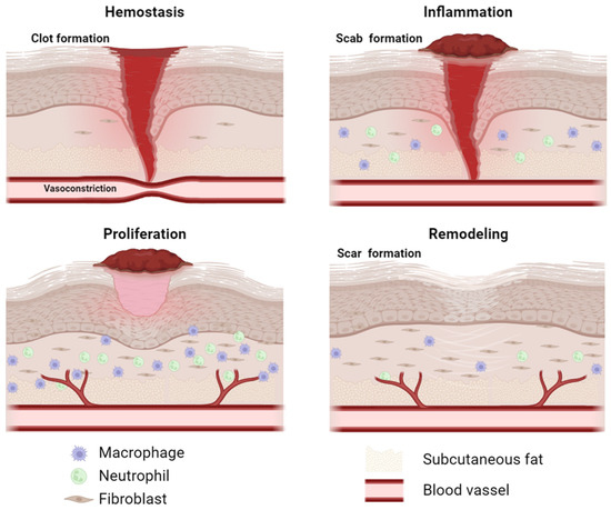 Collagen-Based Scaffolds for Chronic Skin Wound Treatment