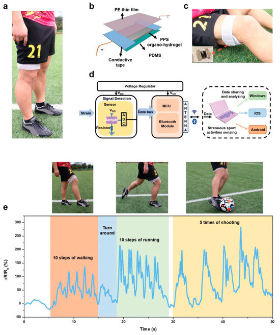 Progress of Research on Conductive Hydrogels in Flexible Wearable Sensors