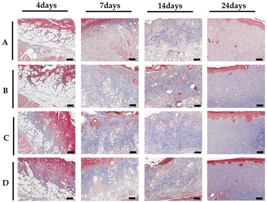Effect of Spray-Type Alginate Hydrogel Dressing on Burn Wounds