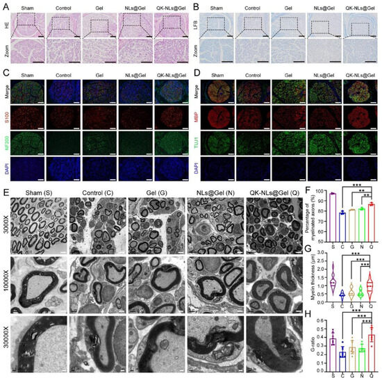 Injectable Hydrogels for Nervous Tissue Repair—A Brief Review