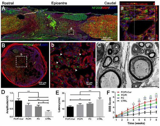 Injectable Hydrogels for Nervous Tissue Repair—A Brief Review