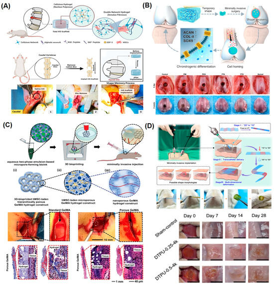 Shape Memory Hydrogels for Biomedical Applications