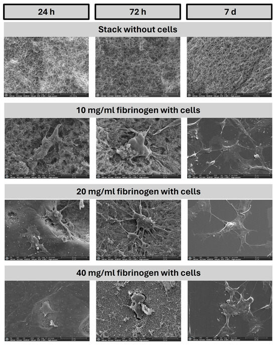 Gels | Free Full-Text | Impact of Fibrin Gel Architecture on Hepatocyte ...