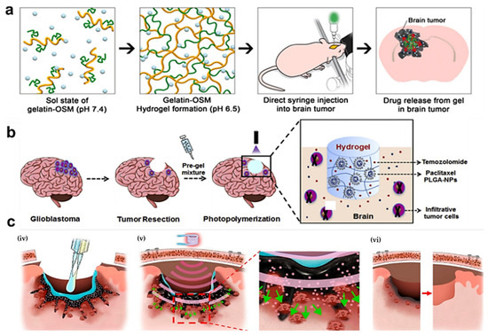 Advances in Hydrogels of Drug Delivery Systems for the Local Treatment ...