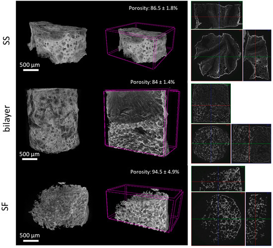 Streamlining Skin Regeneration: A Ready-To-Use Silk Bilayer Wound Dressing