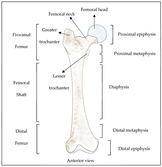 Hydrogel Use in Osteonecrosis of the Femoral Head