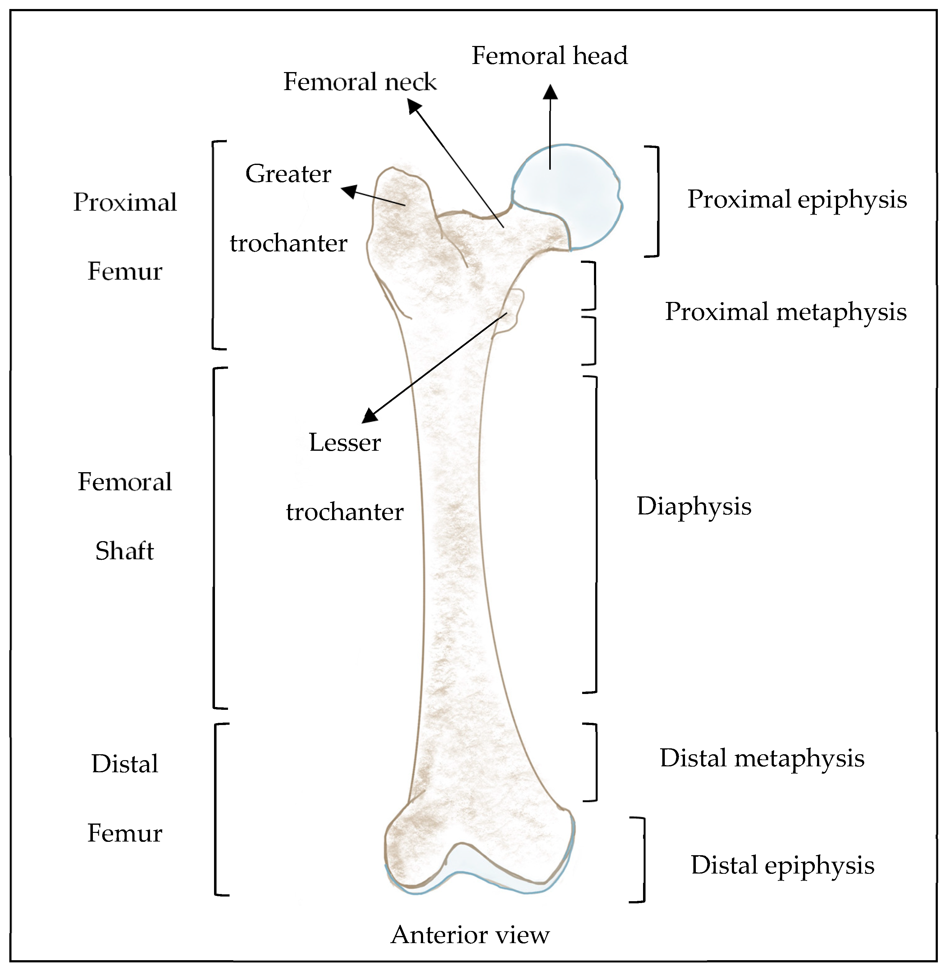 Gels | Free Full-Text | Hydrogel Use in Osteonecrosis of the Femoral Head