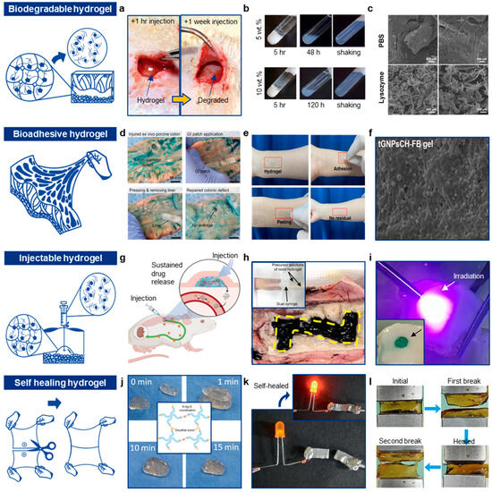 Introductory Review of Soft Implantable Bioelectronics Using Conductive ...