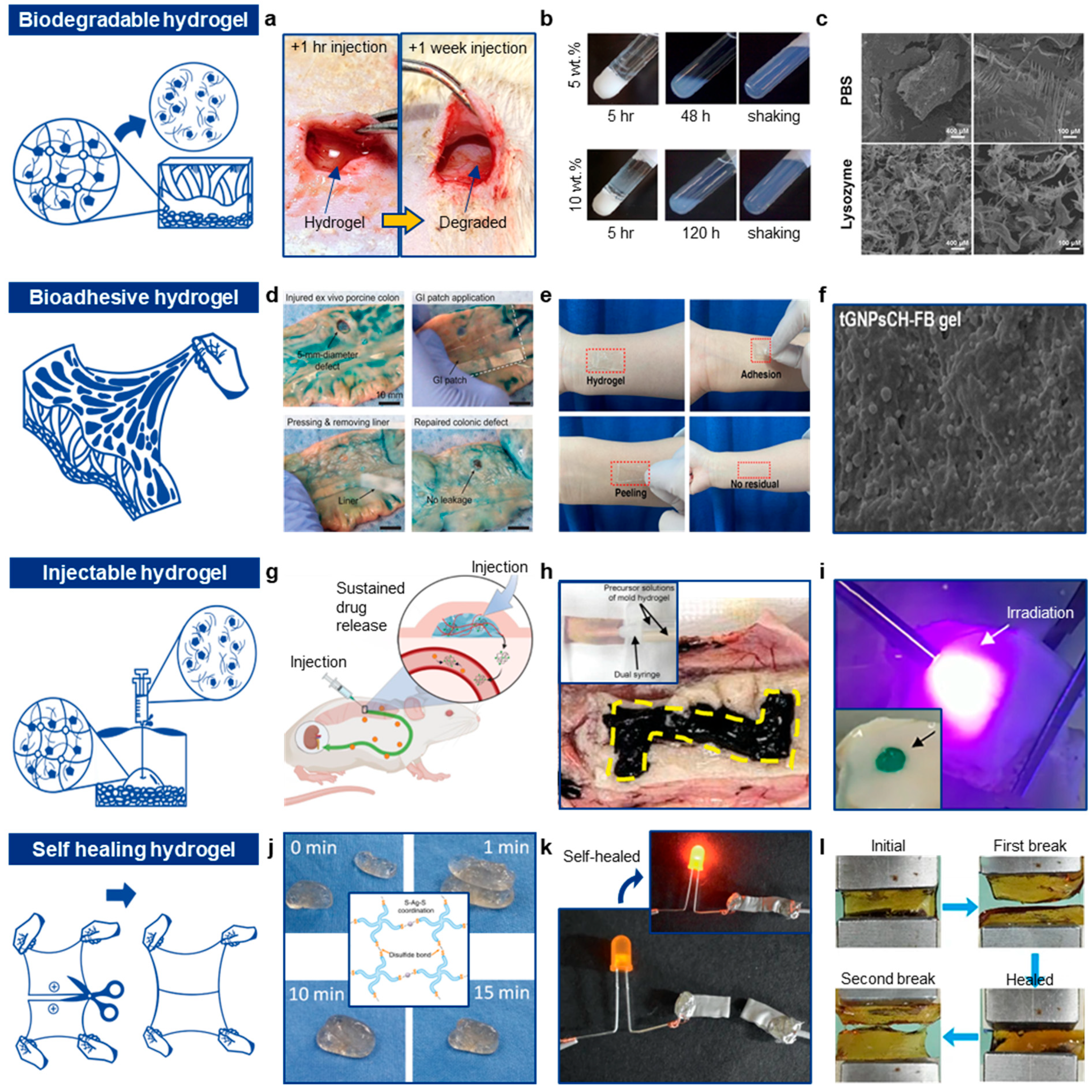Introductory Review of Soft Implantable Bioelectronics Using Conductive and Functional Hydrogels ...