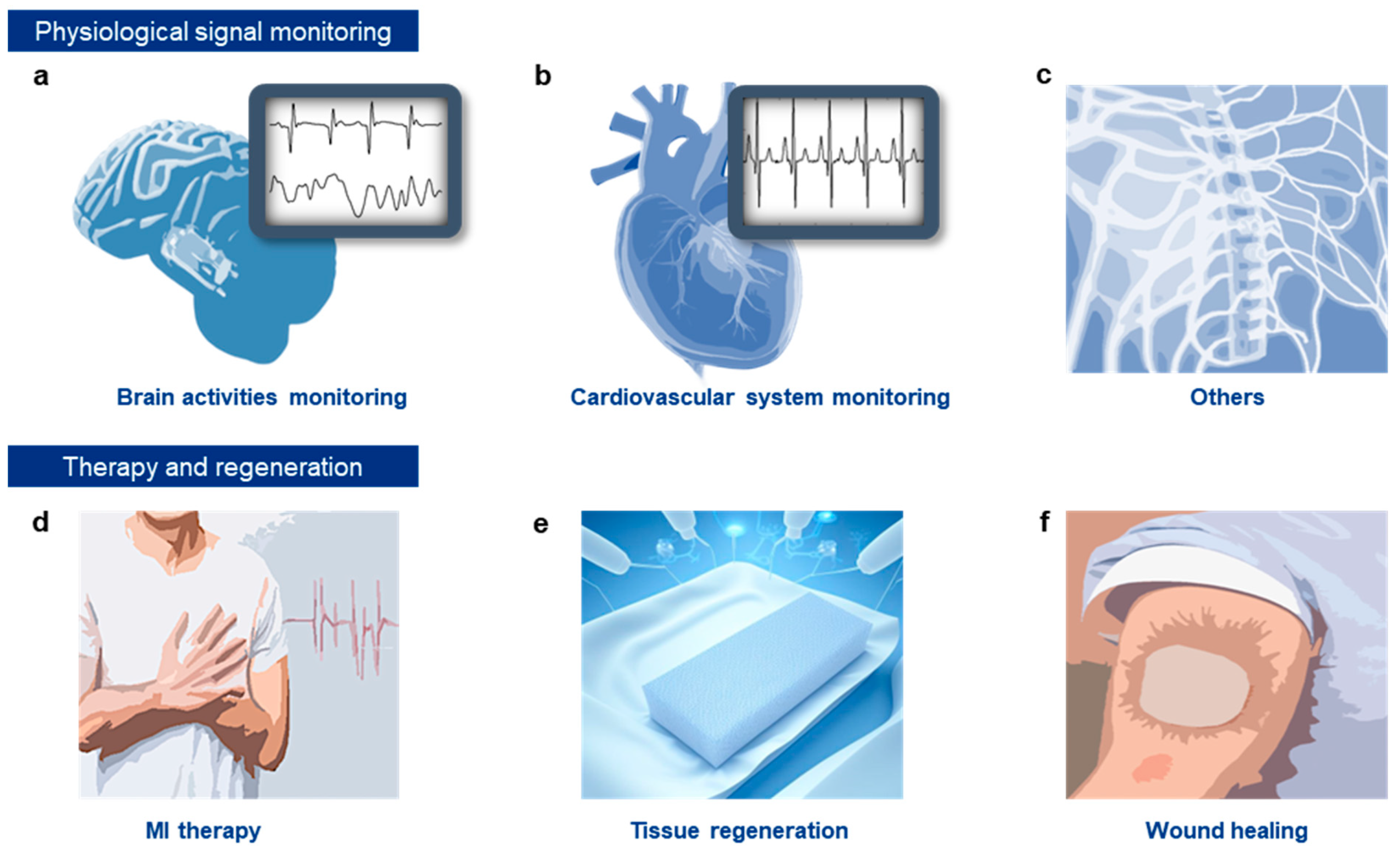 Introductory Review of Soft Implantable Bioelectronics Using Conductive ...