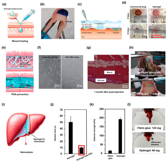Biomedical Application of Enzymatically Crosslinked Injectable Hydrogels