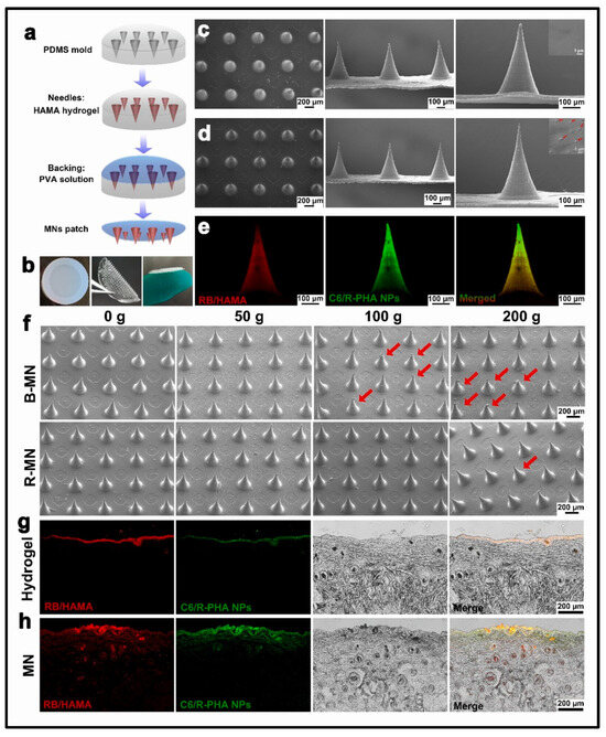 Hydrogel-Forming Microneedles in the Management of Dermal Disorders Through a Non-Invasive ...