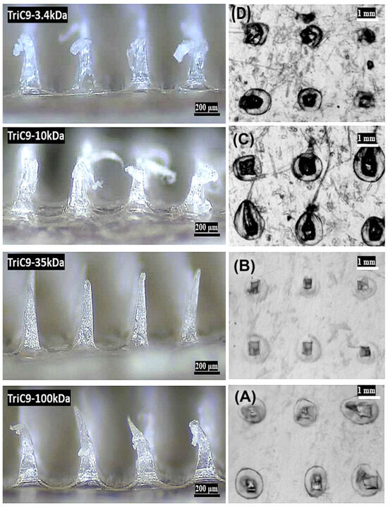Hydrogel-Forming Microneedles in the Management of Dermal Disorders ...
