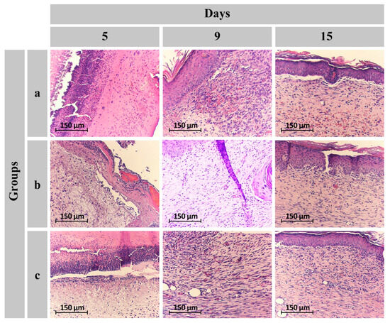 Evaluation of Carboxymethyl Cellulose/Gelatin Hydrogel-Based Dressing ...
