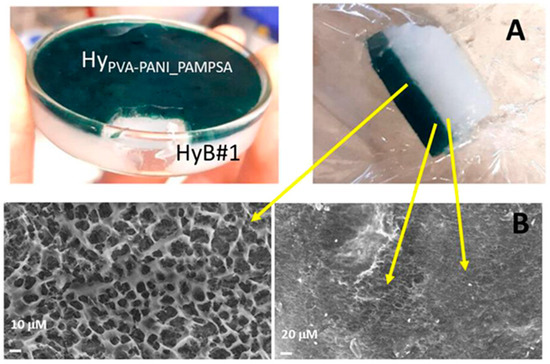 Synthesis of PVA-Based Hydrogels for Biomedical Applications: Recent ...