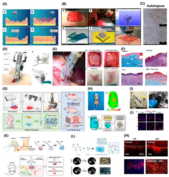 Bioprinting-By-Design of Hydrogel-Based Biomaterials for In Situ Skin ...