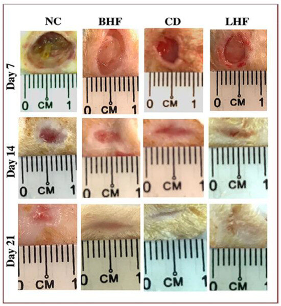 Collagen-Based Wound Dressings: Innovations, Mechanisms, and Clinical ...