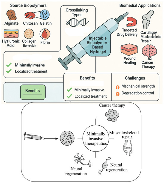 Injectable Biopolymer-Based Hydrogels: A Next-Generation Platform for ...