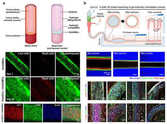 Bioprinting Vascularized Constructs for Clinical Relevance: Engineering ...