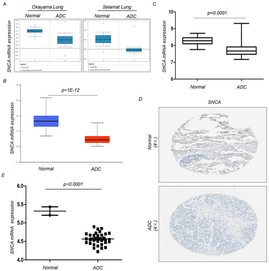 SNCA Is a Functionally Low-Expressed Gene in Lung Adenocarcinoma