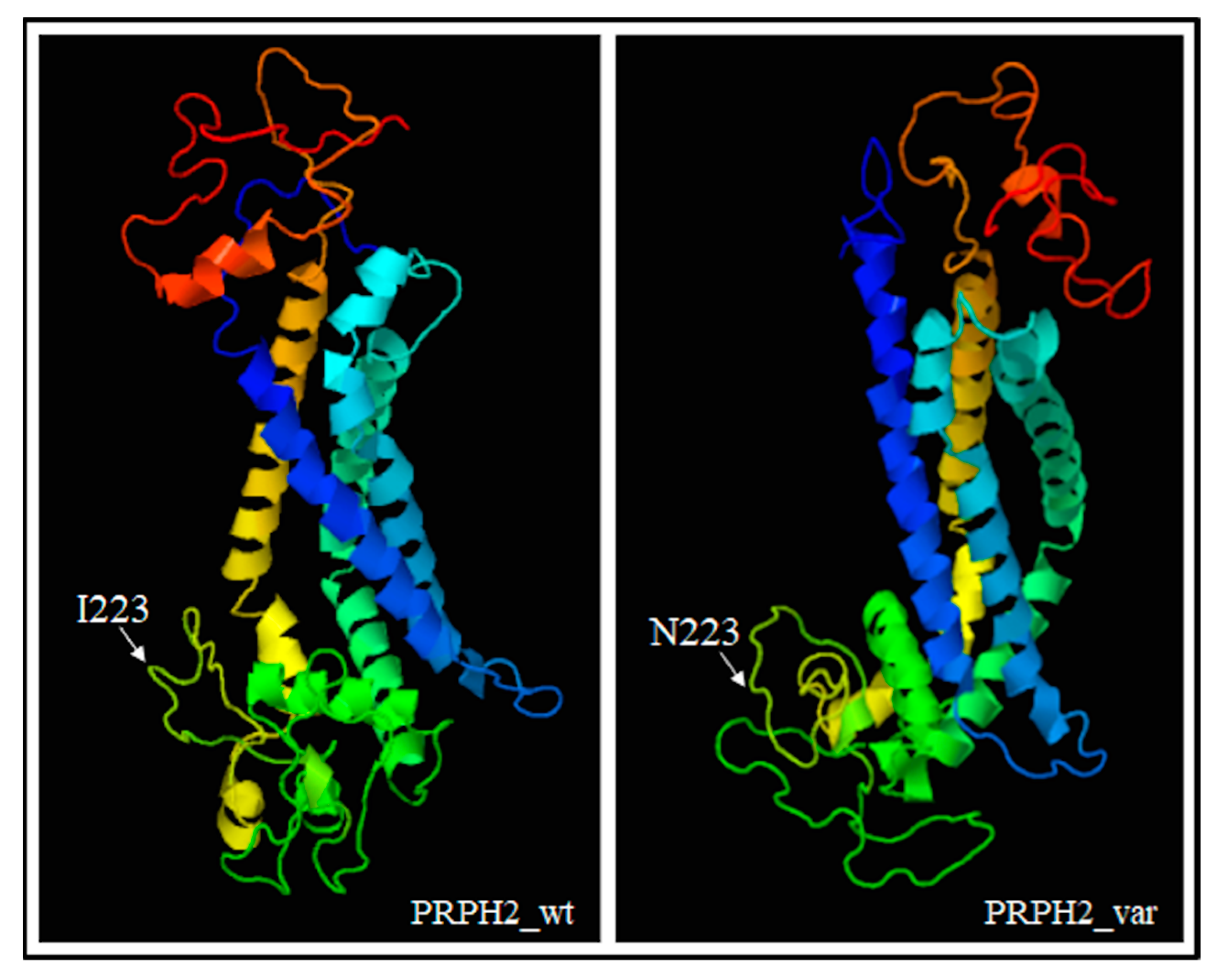 NGS Analysis for Molecular Diagnosis of Retinitis Pigmentosa (RP ...