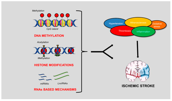 Pathogenesis of Ischemic Stroke: Role of Epigenetic Mechanisms