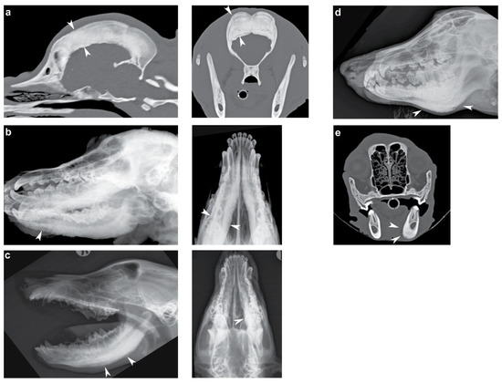Whole Genome Sequencing Indicates Heterogeneity of Hyperostotic ...