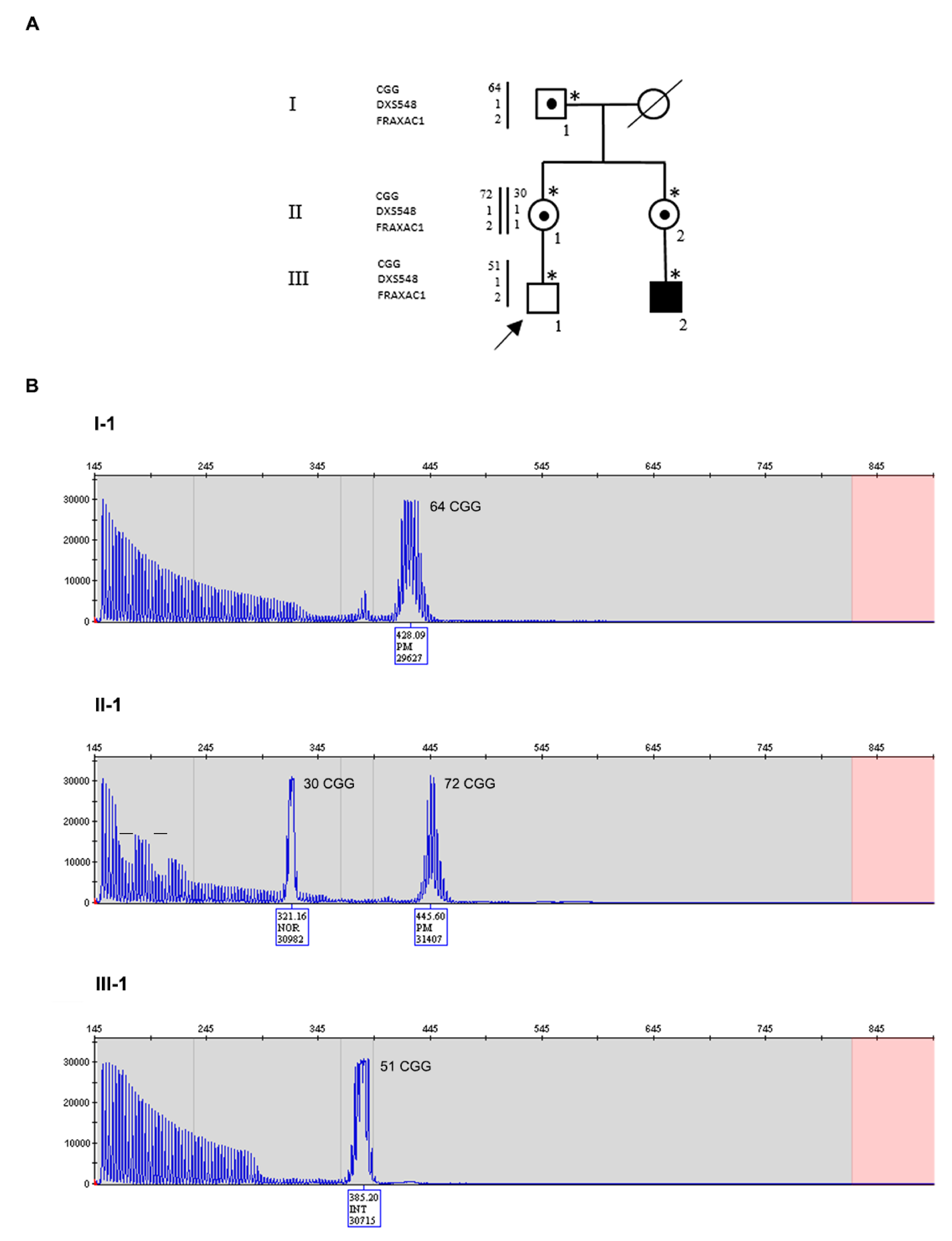 Reversion to Normal of FMR1 Expanded Alleles: A Rare Event in Two ...