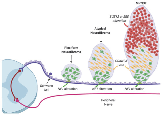 The Role of Polycomb Repressive Complex in Malignant Peripheral Nerve ...
