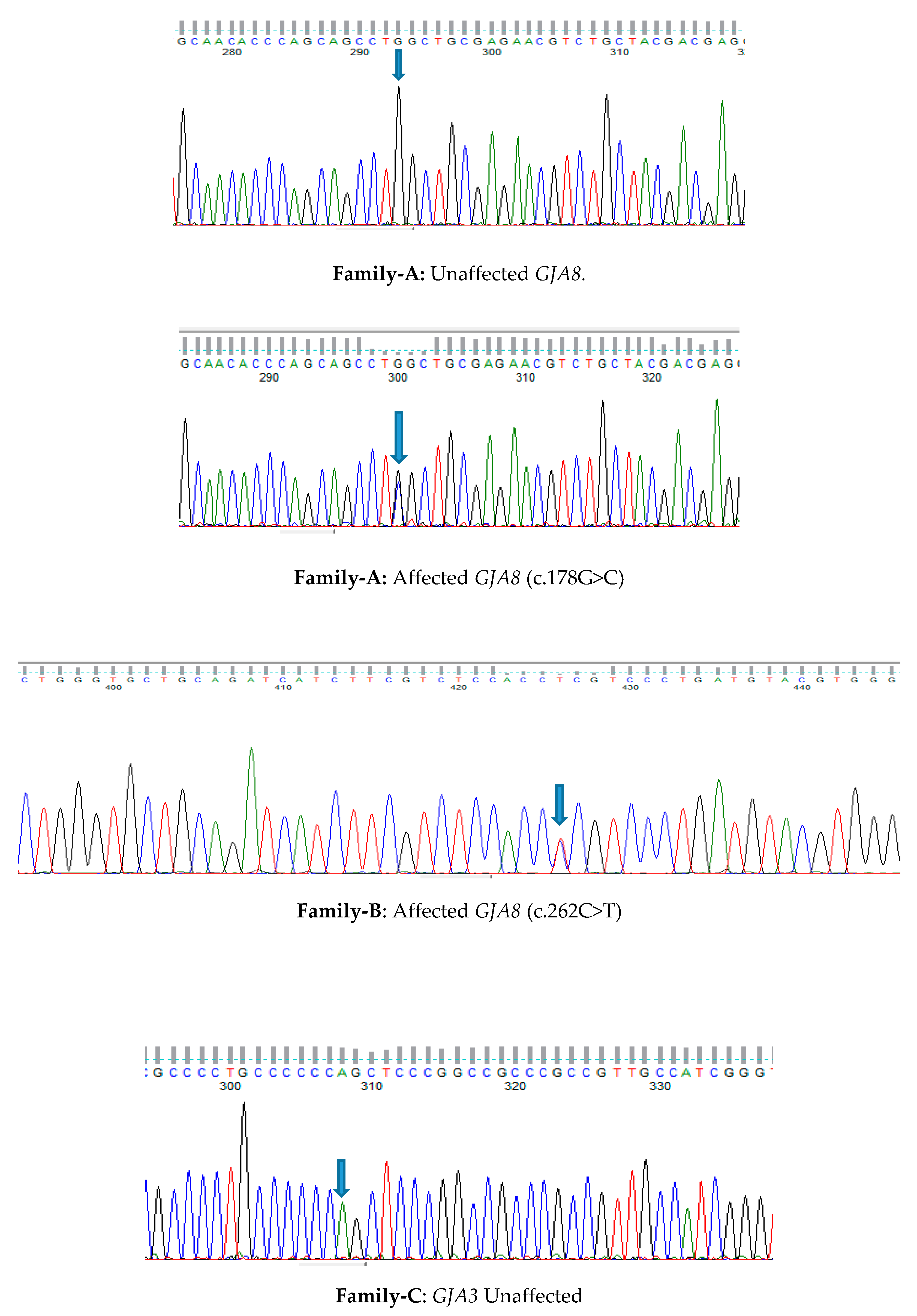 Genes Free Full Text Whole Exome Sequencing Reveals Novel And