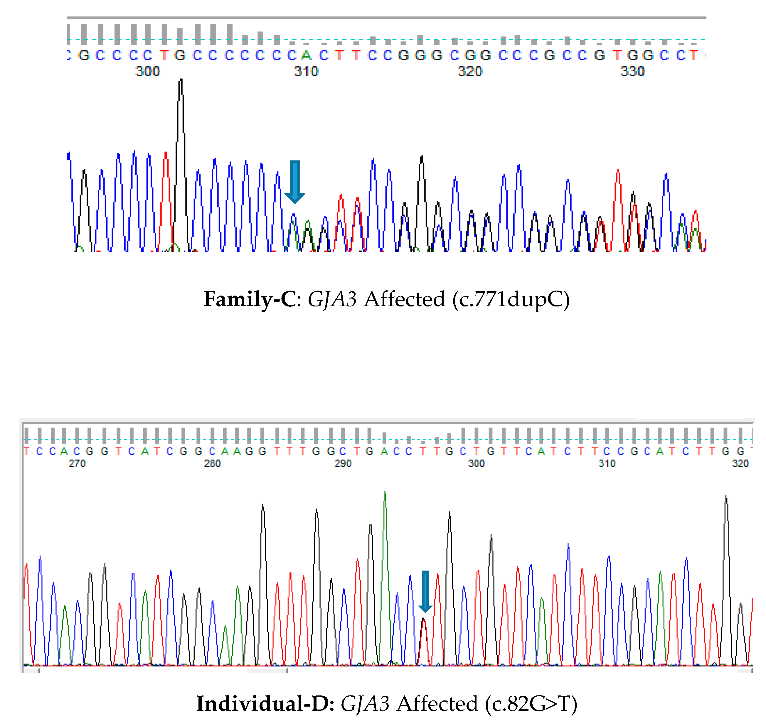 Genes Free Full Text Whole Exome Sequencing Reveals Novel And