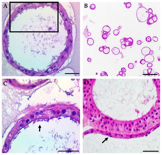 Human Nasal Epithelial Organoids for Therapeutic Development in Cystic ...