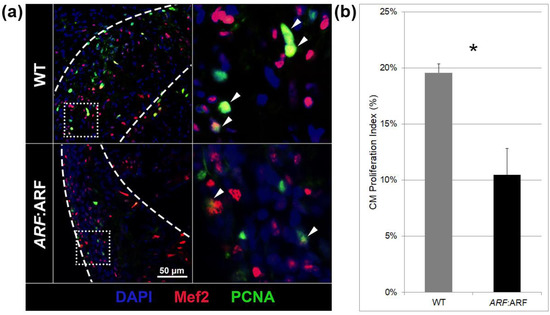Human ARF Specifically Inhibits Epimorphic Regeneration in the ...