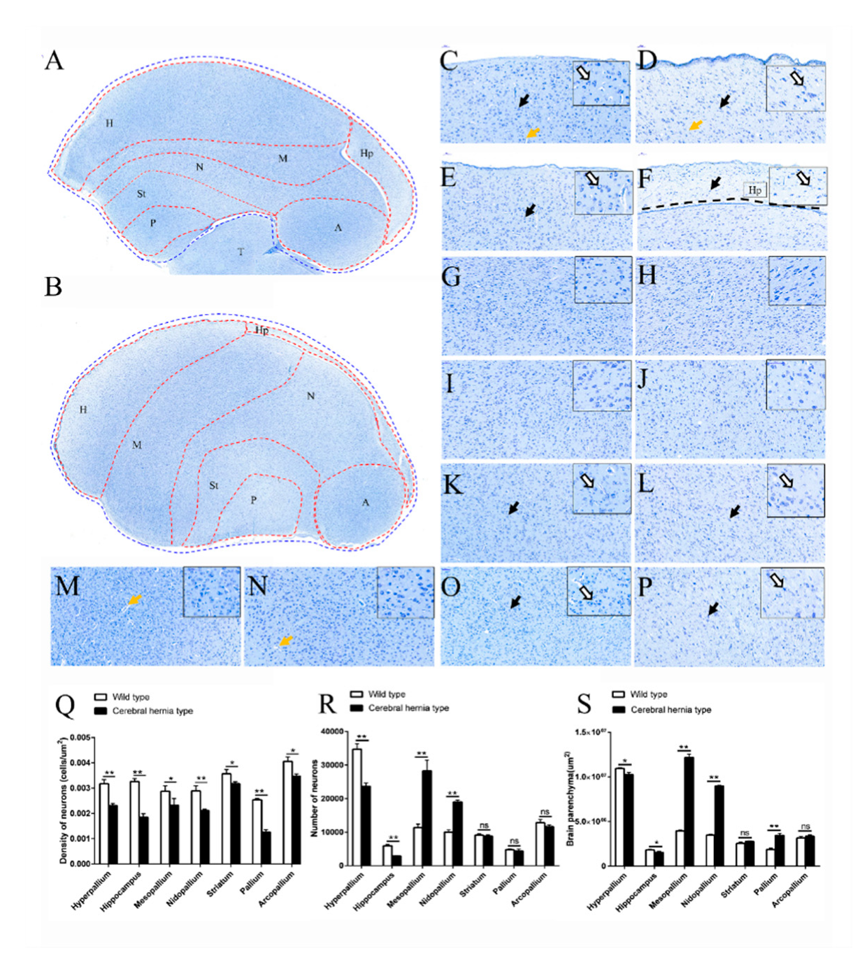 Deciphering the Forebrain Disorder in a Chicken Model of Cerebral Hernia