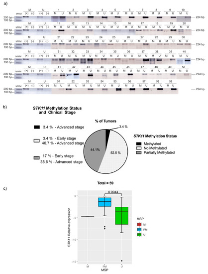 Negative Regulation of Serine Threonine Kinase 11 (STK11) through miR ...