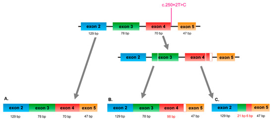 A Mild Phenotype Caused by Two Novel Compound Heterozygous Mutations in ...