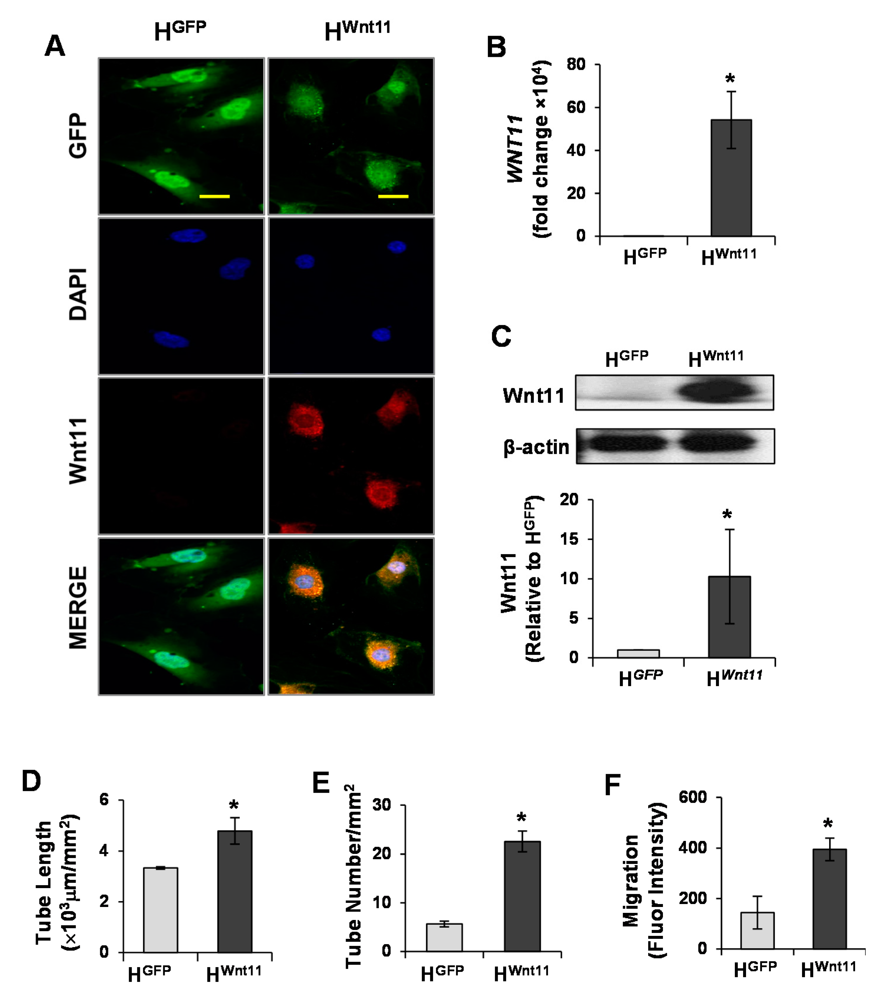 WNT11-Conditioned Medium Promotes Angiogenesis through the Activation ...