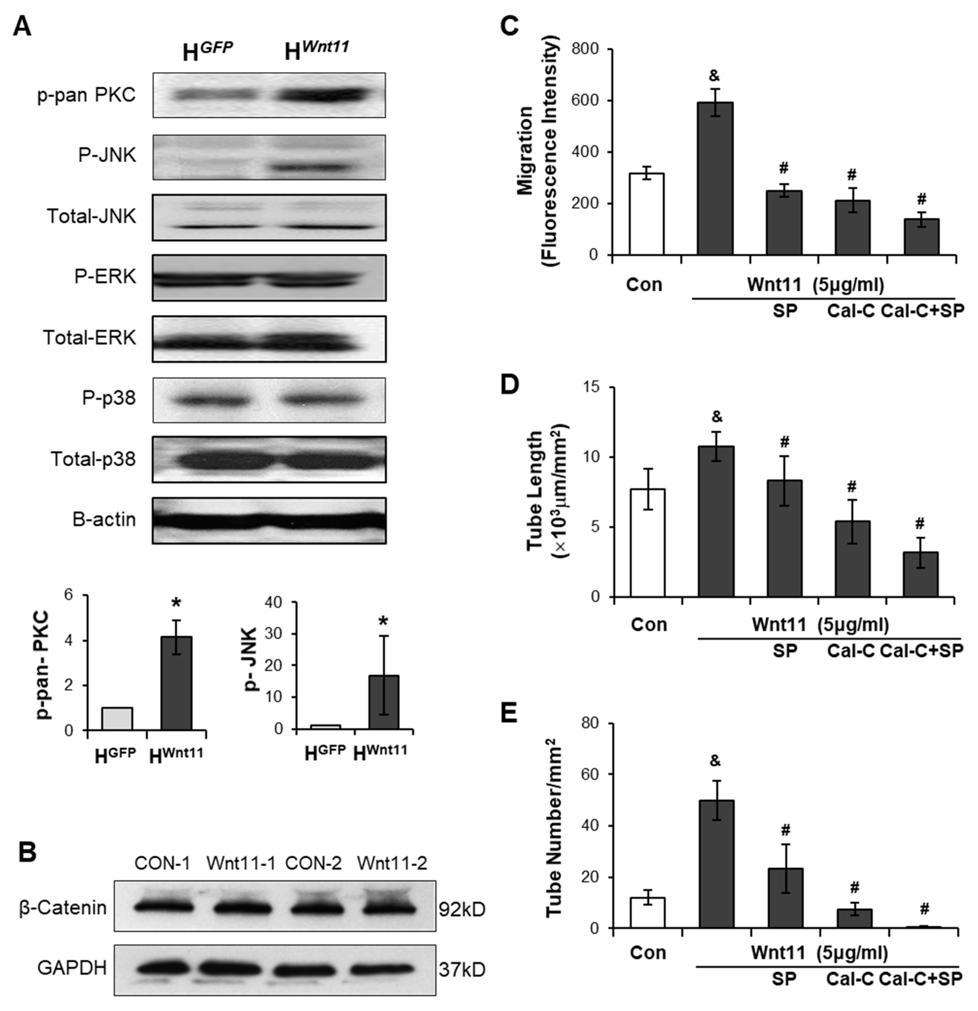 WNT11-Conditioned Medium Promotes Angiogenesis through the Activation ...
