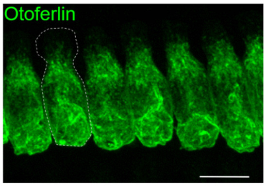 The Many Faces of DFNB9: Relating OTOF Variants to Hearing Impairment