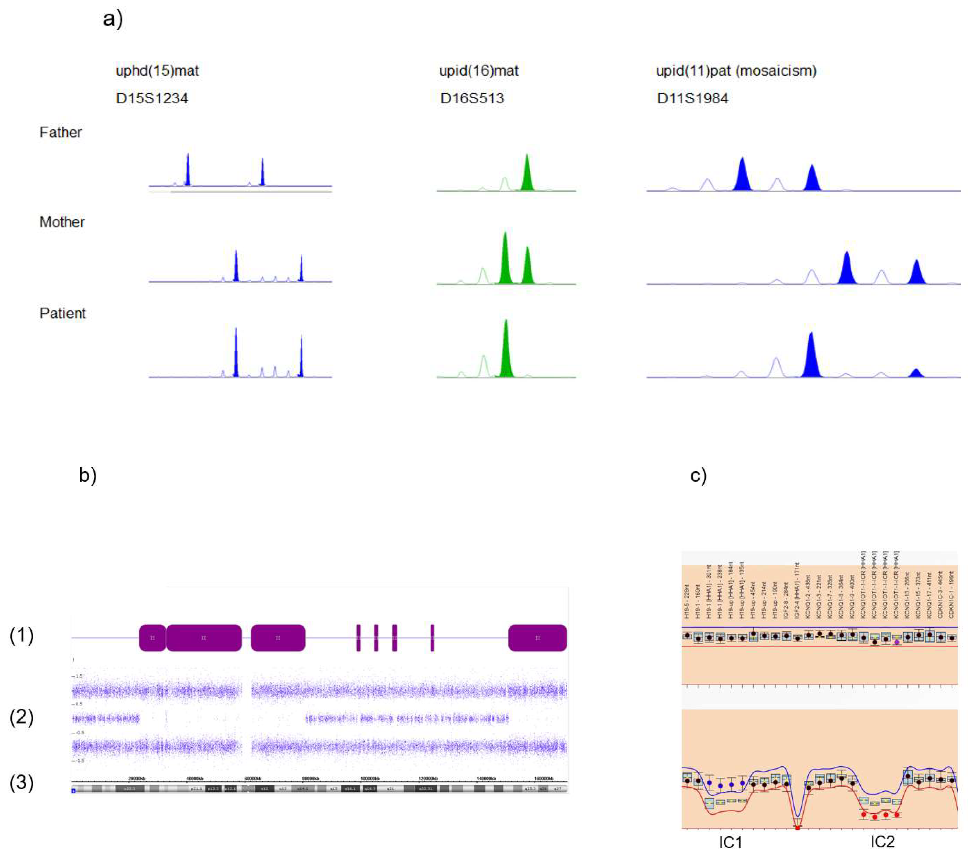 Prenatal Detection of Uniparental Disomies (UPD): Intended and ...
